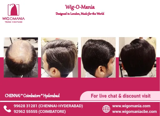 Natural Looking Wigs for Men & Hair Patch @Wigomania -100%Human Hair Wigs